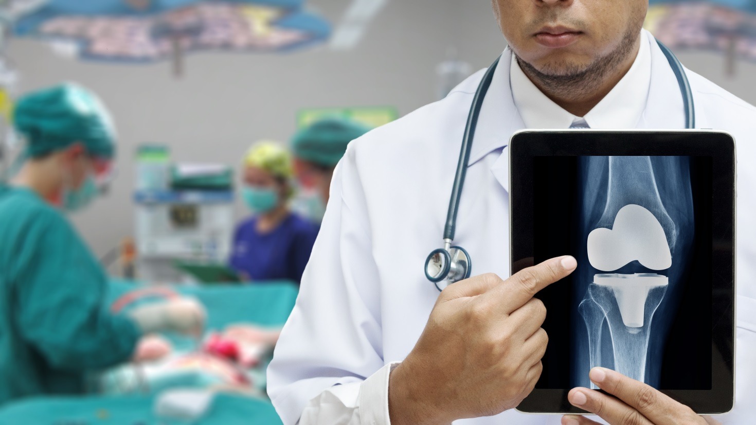 A Comprehensive Overview of Knee Joint Replacement Surgery